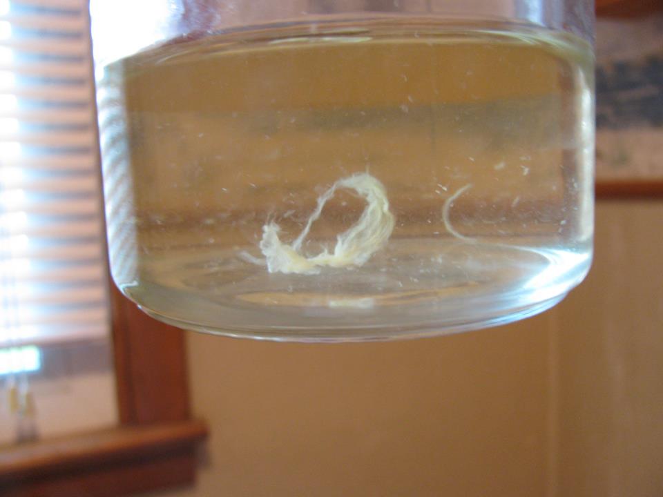 Urine Sediment w Pictures GrapeGate